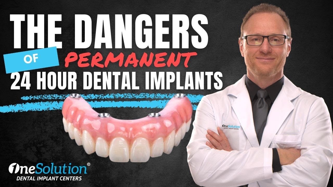 The Dangers of Getting Permanent Dental Implants in 24 hours!