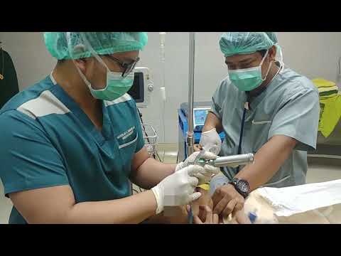 Anesthesia in Action