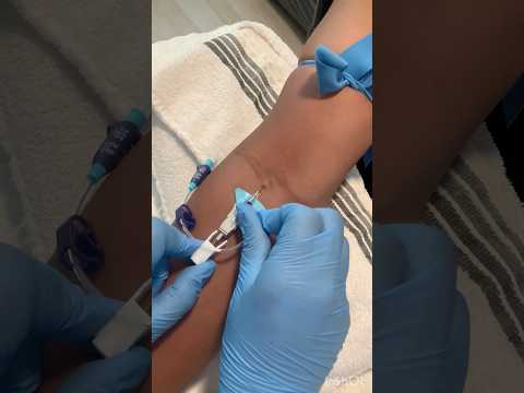 Venipuncture: How to start an IV in the antecubital (AC).