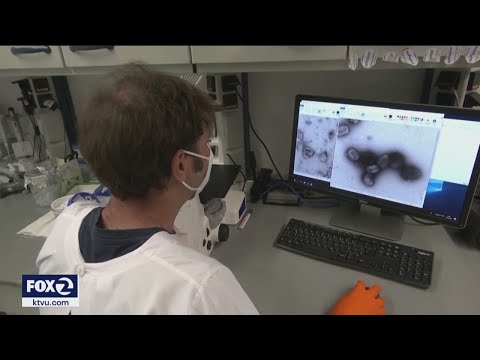 San Francisco health officials identify 1st probable case of monkeypox in resident