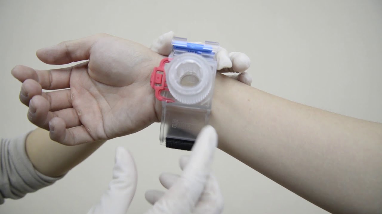 Radial Artery Compression Tourniquet