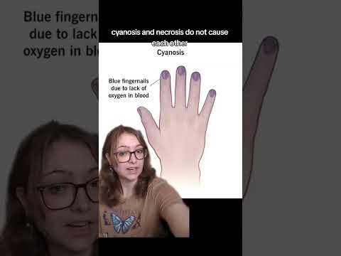 Cyanosis