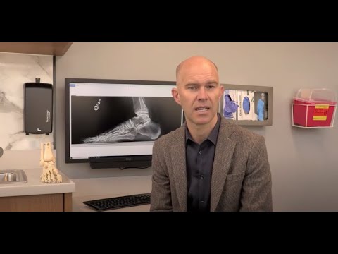 Treatment Options for Hammertoe