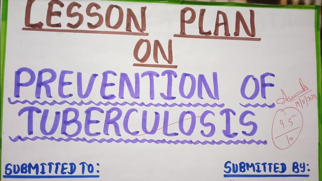 health talk / lesson plan  on TB (tuberculosis )|| prevention on tuberculosis || Nursing student