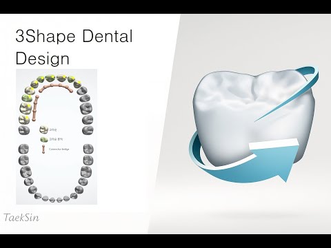 #01 3shape dental design. Implement Crown Bridge.#3shape