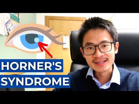 What you need to know about Horner's syndrome
