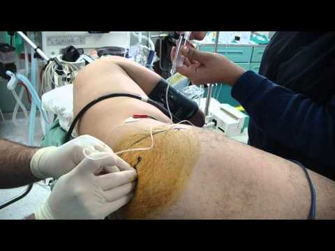 251 General Hellenic Air Force Hospital -sciatic nerve block.MP4