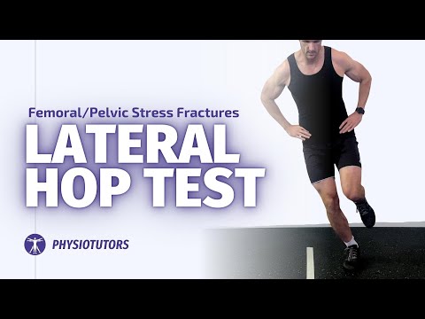 Lateral Hop Test / ZigZag Hop Test | Femoral Stress Fractures