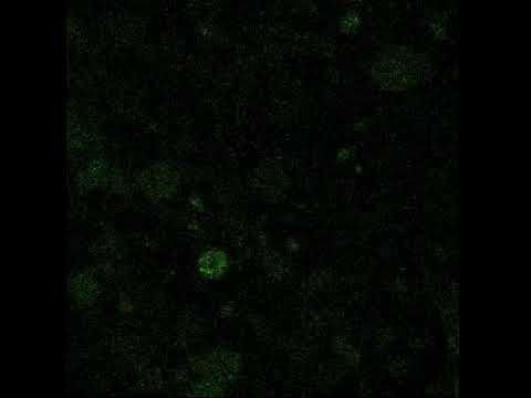 Cupid GFP cell penetrating peptide seen throughout cytosol in mouse heart cells