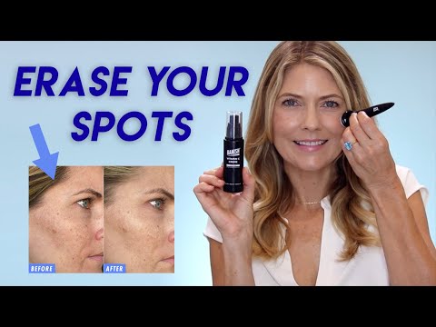 Erase Pigmentation And Scars Fast With The Banisher Microstamping Tool!