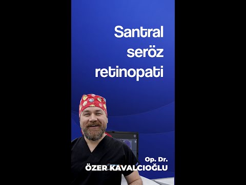 Santral Seröz Retinopati (SSR) Nedir?