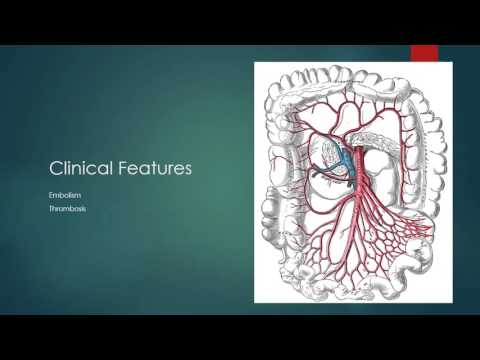 Ischemic Enteritis