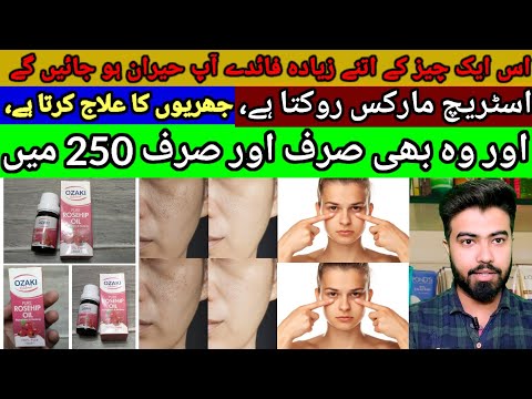 Rosehip Oil | Rosehip Oil for Face | Rosehip oil benefits | Rosehip oil for hair
