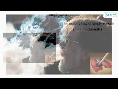 emphysema (English) - Medical terminology for medical students -
