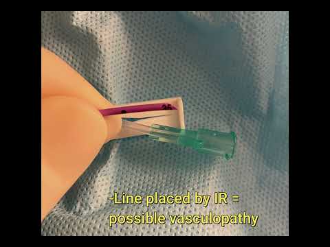 Case Study: Inappropriate PICC Tip Location (Mid Subclavian)