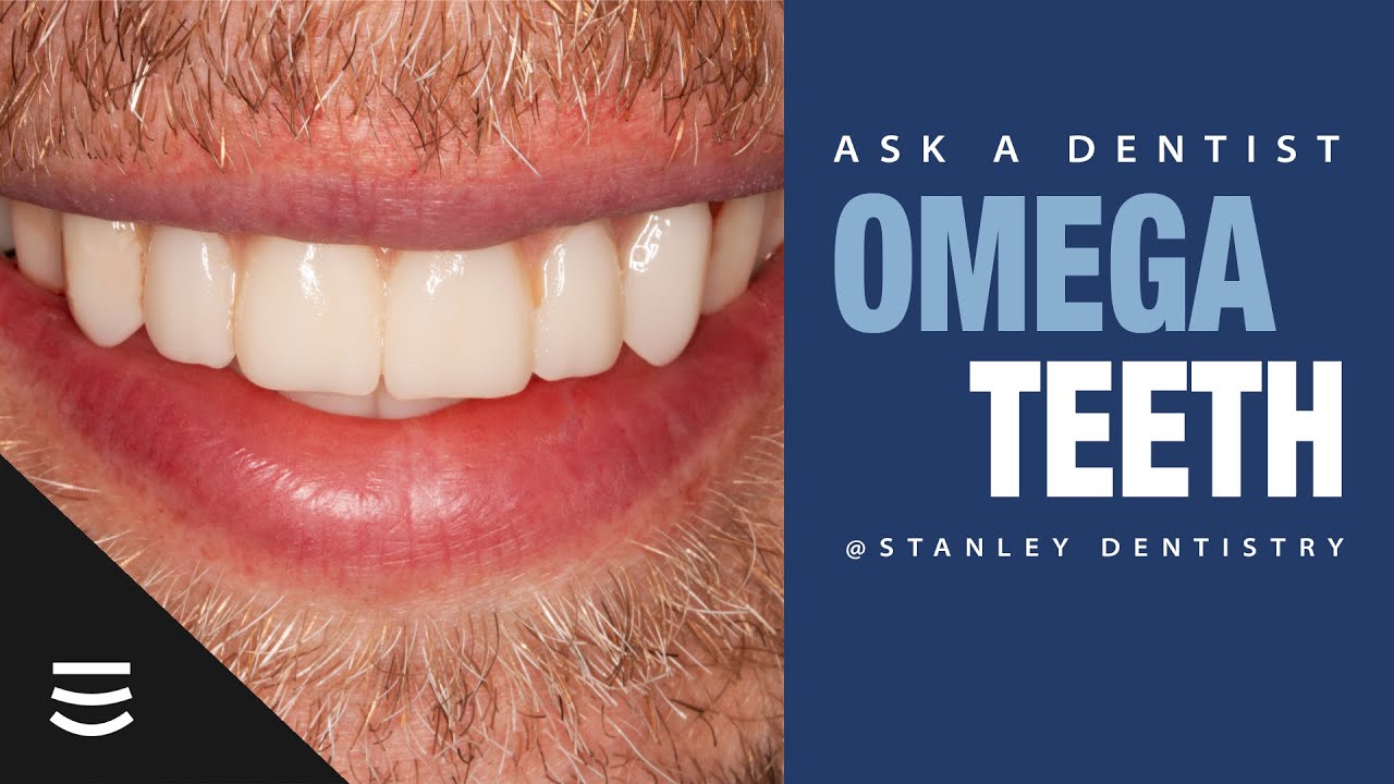 Ask a Dentist: What Are Omega Teeth Dental Implants?