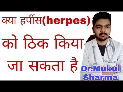 Genital herpes cure | Herpes simplex virus in hindi | HSV 1 and HSV 2 igg positive meaning
