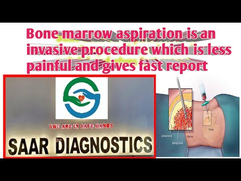 Bone marrow aspiration in a case of Multiple Myeloma) || BMA || Bone marrow examination