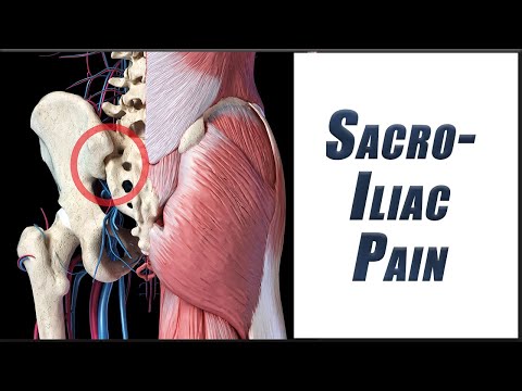 Best 3 Exercises for SI (Sacroiliac) Joint Pain Relief