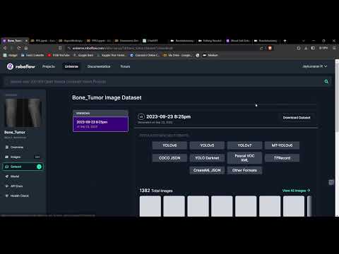 Roboflow Dataset How to use for Yolo| Yolov8| Tutorial |Google Colab Train