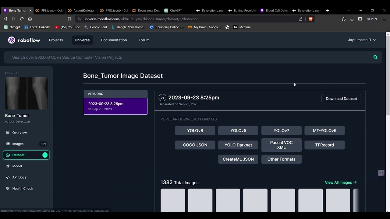Roboflow Dataset How to use for Yolo| Yolov8| Tutorial |Google Colab Train