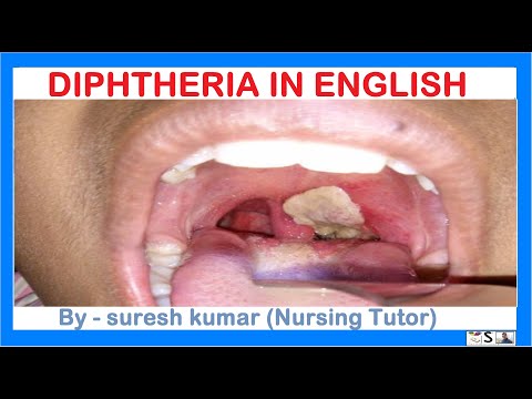 DIPHTHERIA IN ENGLISH