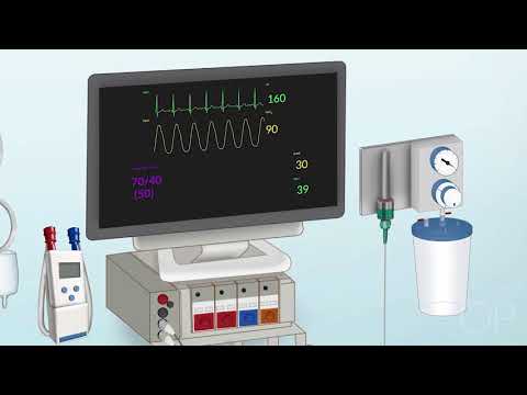 Sepsis in the Hematopoietic Stem Cell Transplant Patient by L. Lehmann | OPENPediatrics