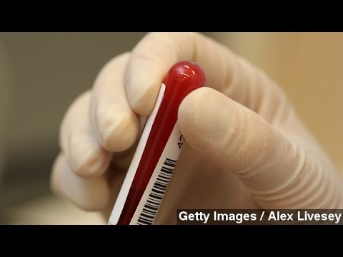 Can A Blood Test Predict Psychosis Risk?