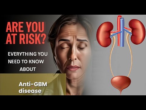 Anti-GBM disease Explained Causes, Symptoms and Treatment, All Insights