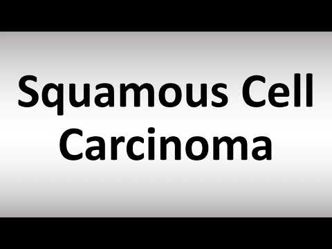 How to Pronounce Squamous Cell Carcinoma