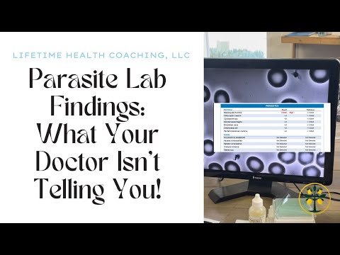 Parasite Lab Findings: What Your Doctor Isn't Telling You!