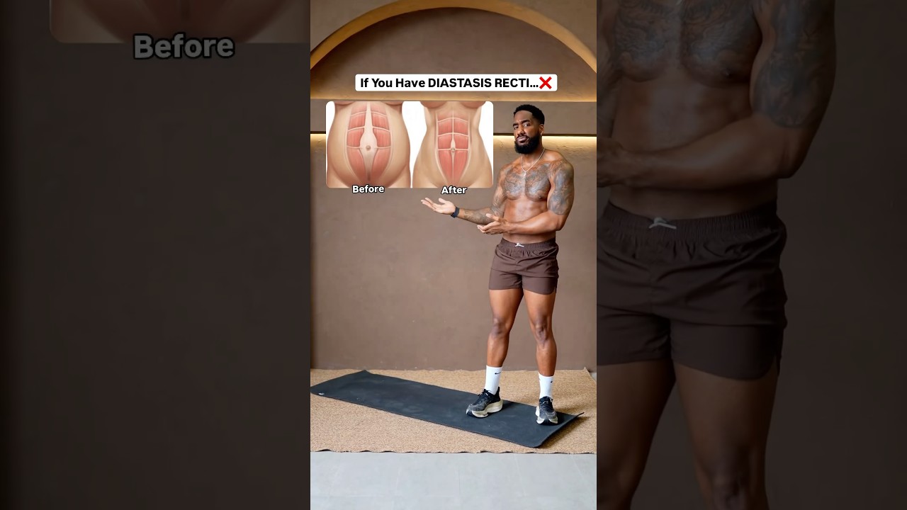 If You Have DIASTASIS RECTI… (Do This!)✅