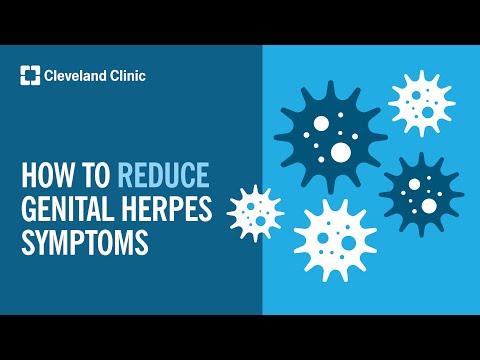 How To Reduce Genital Herpes Symptoms