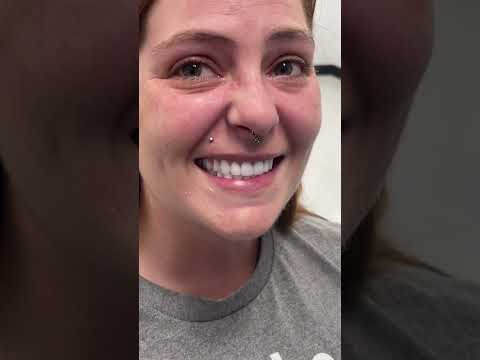 Ashley | Affordable Dentures & Implants Moments