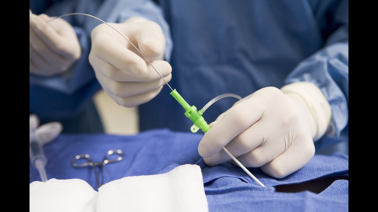 Vascular Access Tips