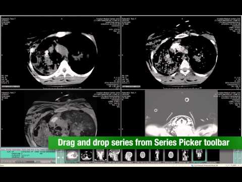Synapse integration with Citrix