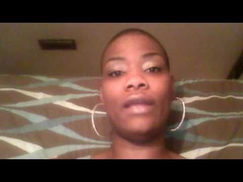 Treatment Of Oropharyngeal Candidiasis By Oravig (Miconazole) Buccal ...