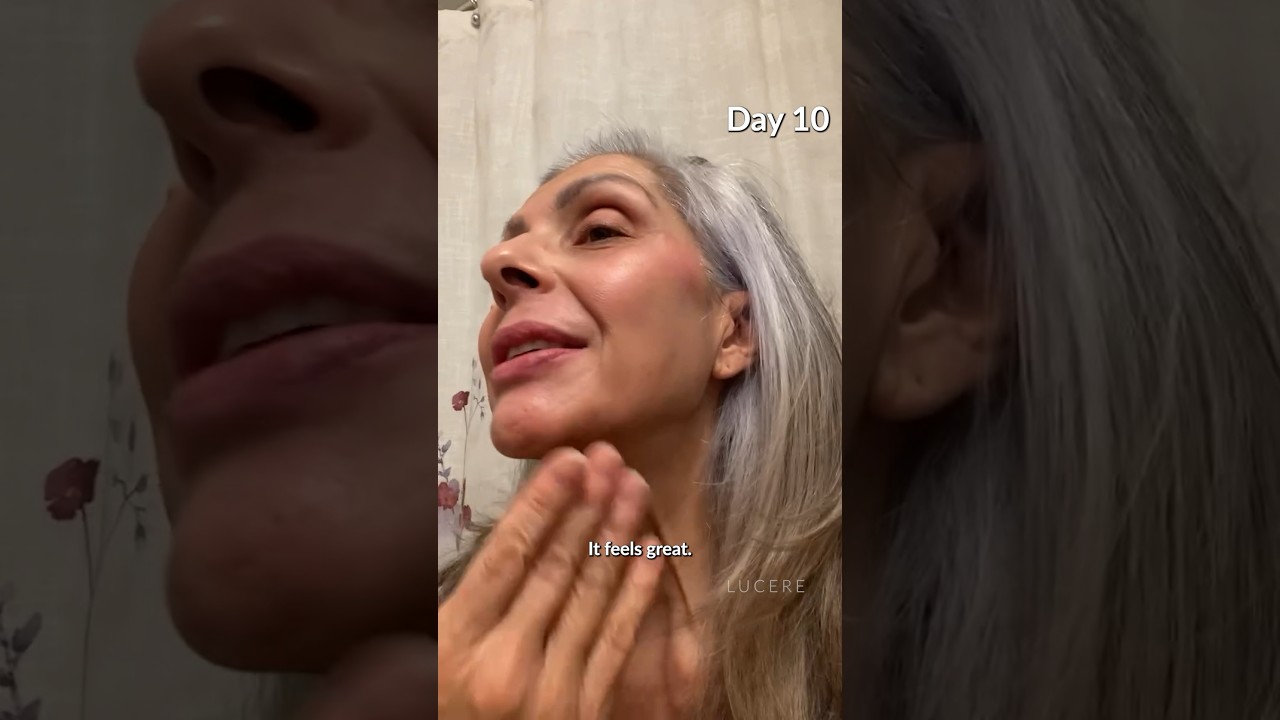 Skin recovery from the Fotona Skin Tightening laser treatment part 1