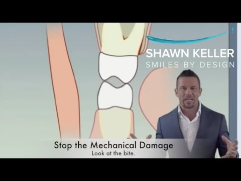 You Must Watch This Before Your Laser Cleaning