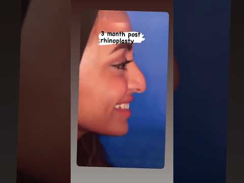 Facial Plastic Surgeon NYC | Dr. Sam Rizk