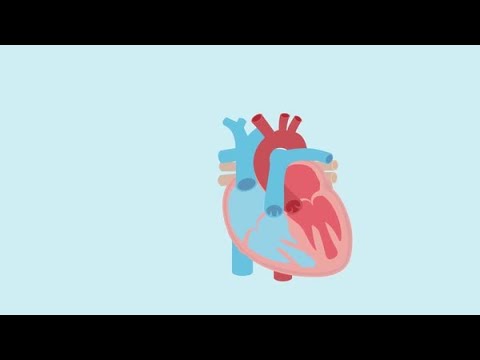 What is an ICD?