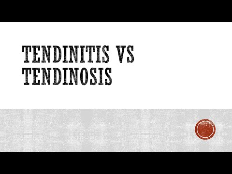 Tendinitis vs Tendinosis