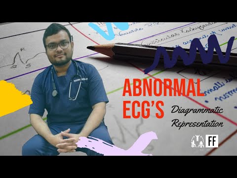 Abnormal ECG patterns (diagrammatic) including Fibrillation, Heart Block, Tachycardia, Asystole