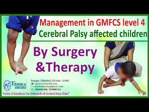 Management in GMFCS level 4 cerebral palsy affected children – Cerebral ...