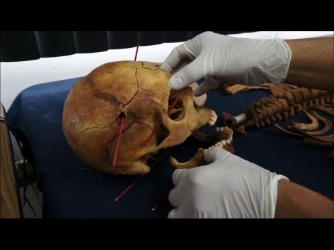 From Guatemalan Soil, Scientists Unearth Signs of Genocide