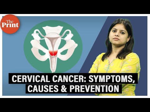 Cervical cancer is the 2nd most common cancer among Indian women- All you need to know about it