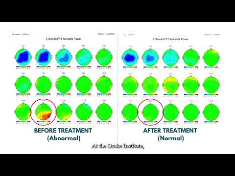 Treating ADHD Without Medication at the Drake Institute