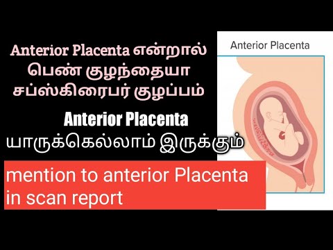 anterior placenta is girl baby full detail video and special reply to subscribers questions....tamil