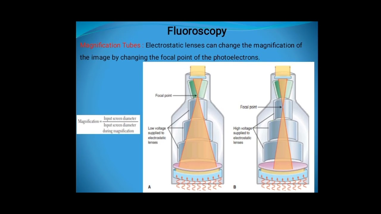 Understanding Fluoroscopy: Key Factors Affecting Image Brightness and ... Understanding Fluoroscopy: Key Factors Affecting Image Brightness and ...