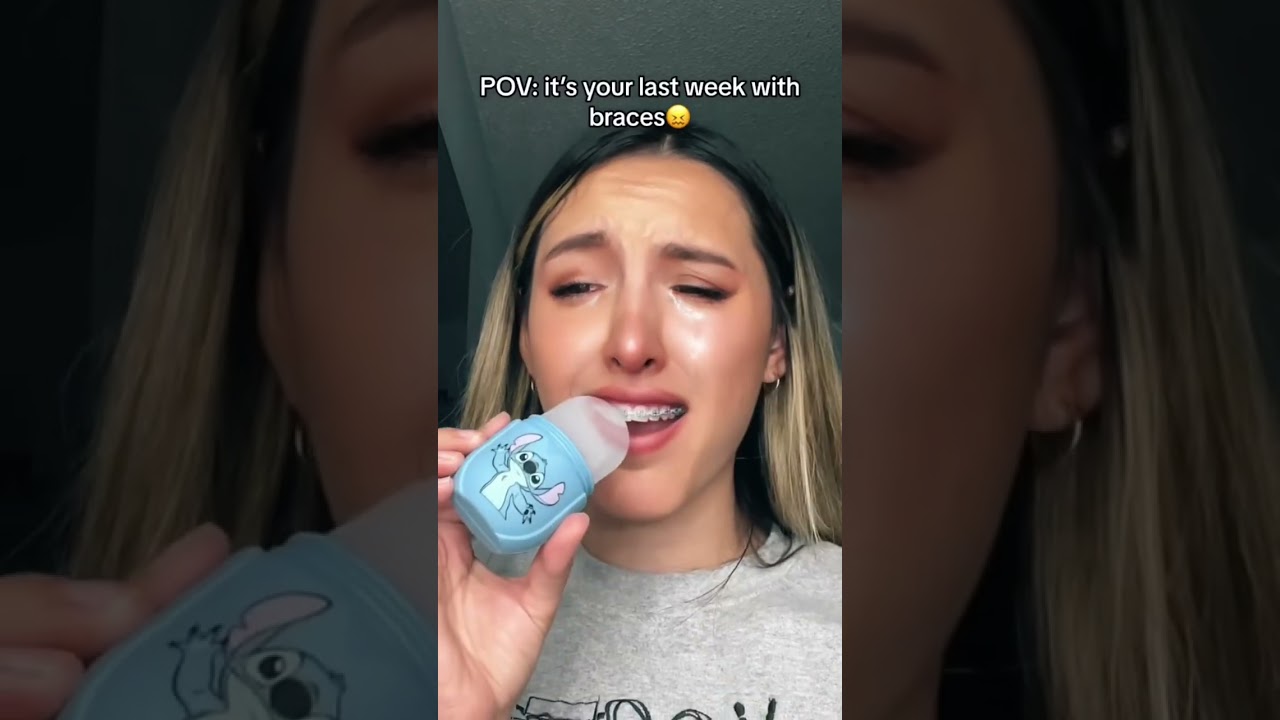 So much painnnn #autumnmonique #braces #youtubeshorts